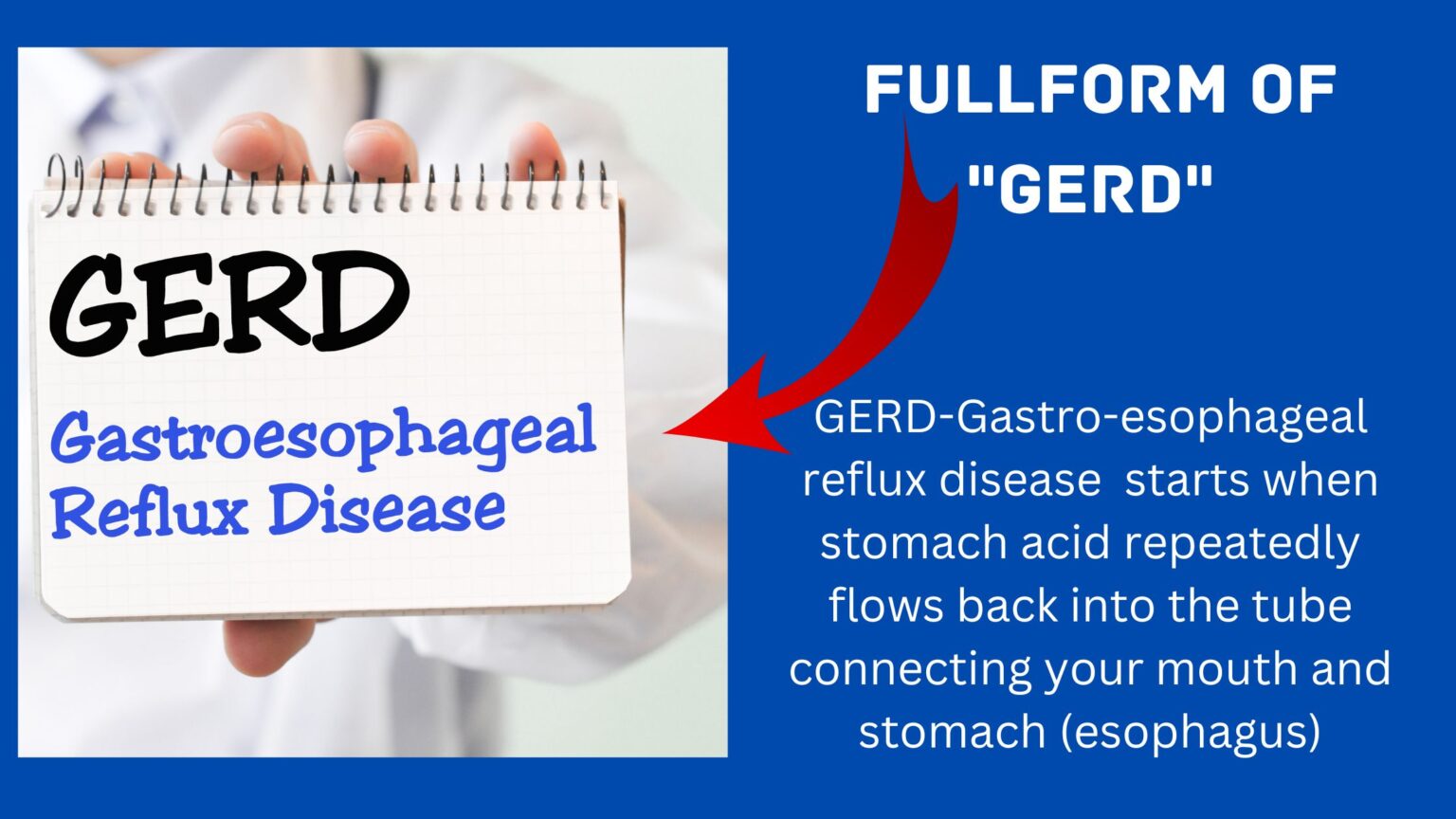 ICD 10 for GERD (2025)